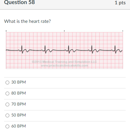 Question 58 What is the heart rate? سلسل السله O 30 | Chegg.com