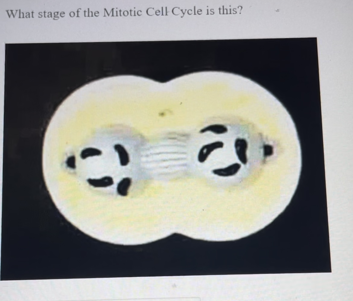 Solved What stage of the Mitotic Cell Cycle is this? | Chegg.com