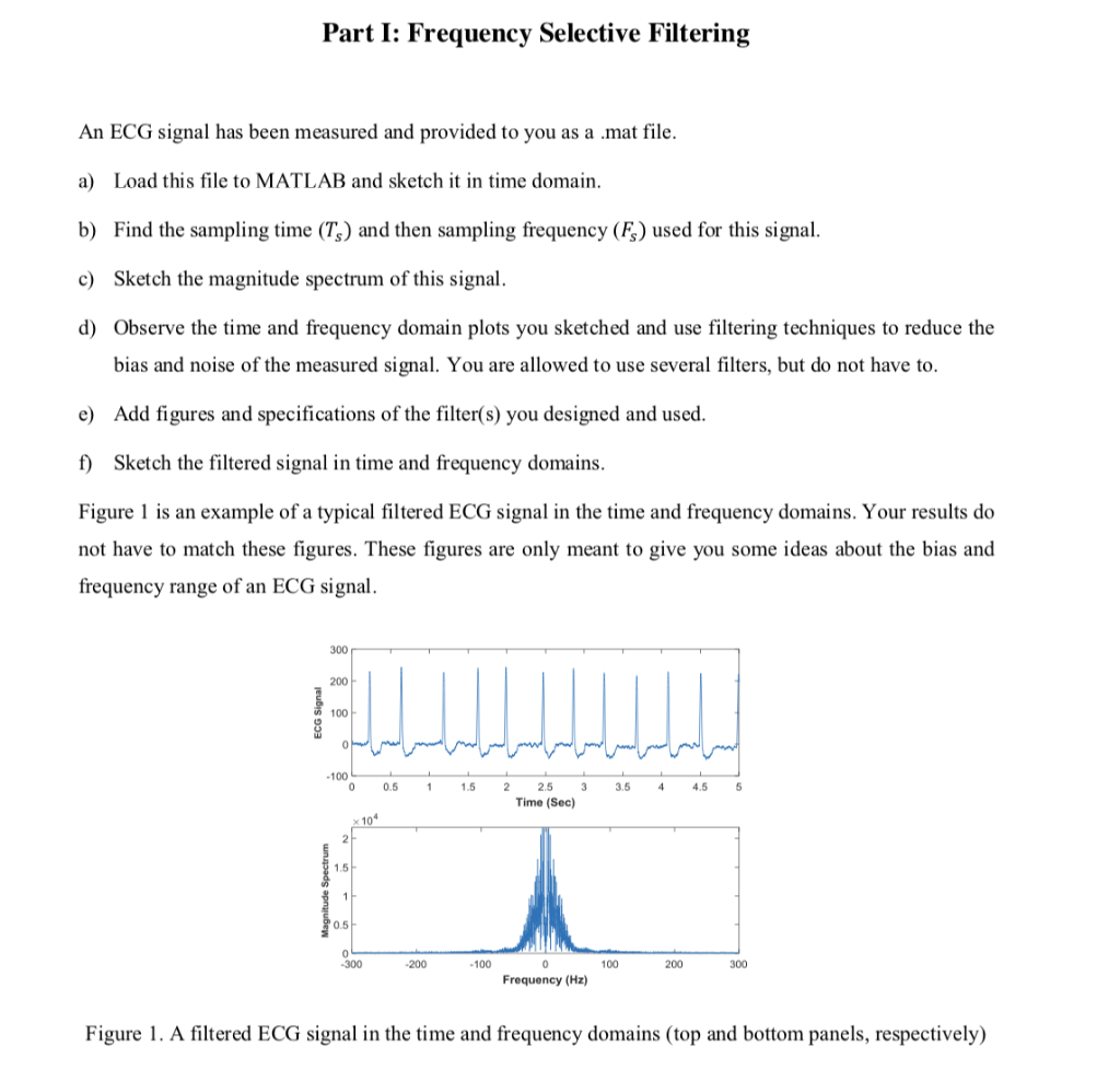 This is a Signals and Systems MATLAB Assignment. | Chegg.com