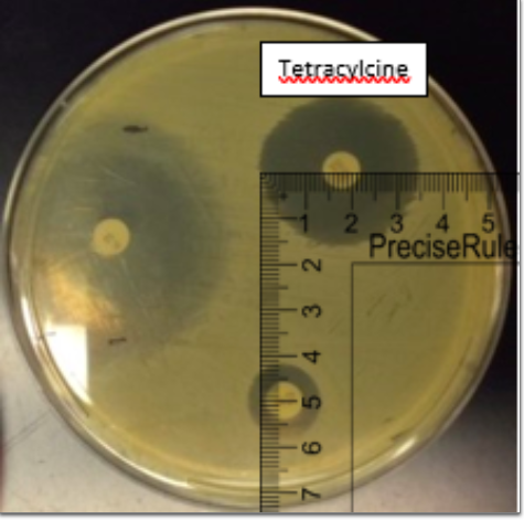 Three antibiotics discs, penicillin, streptomycin and | Chegg.com