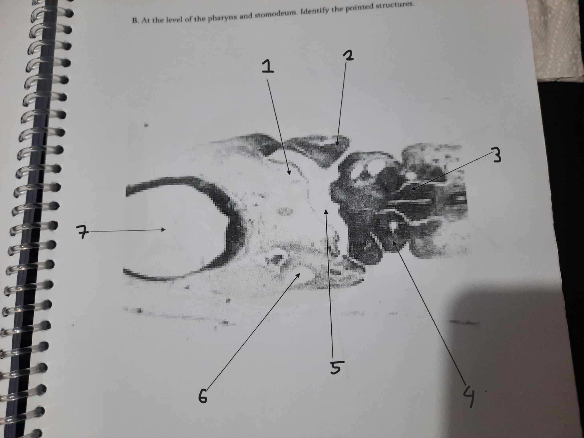Solved At the level of the pharynx and stomodeum. Identify | Chegg.com
