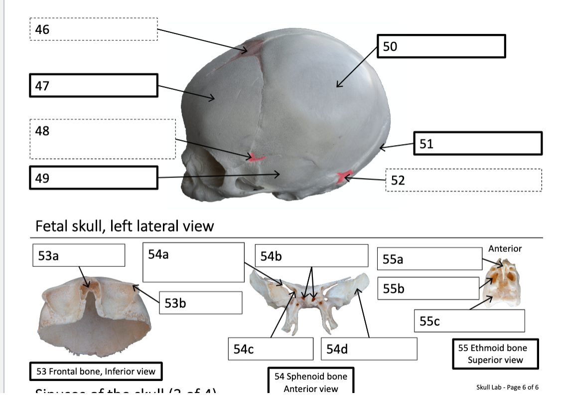 Solved 1 6 2 Coronal suture 7 3 Parietal bone 7a 8 9 ----- 4 | Chegg.com