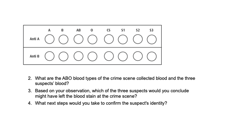Solved Forensics Blood Typing Imagine you are a CSI | Chegg.com
