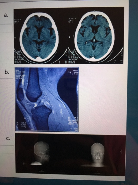 Solved Label the planes in each of the three x-rays. | Chegg.com