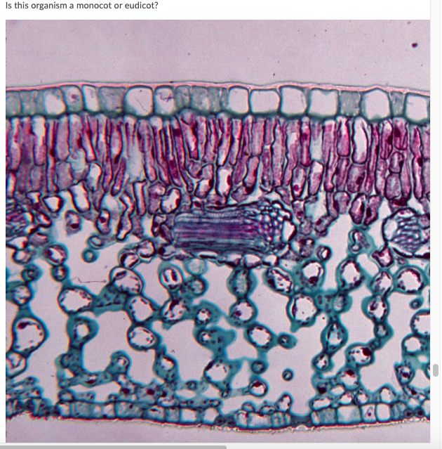 Solved Of what type of tissue are the grainy "stone cells" | Chegg.com