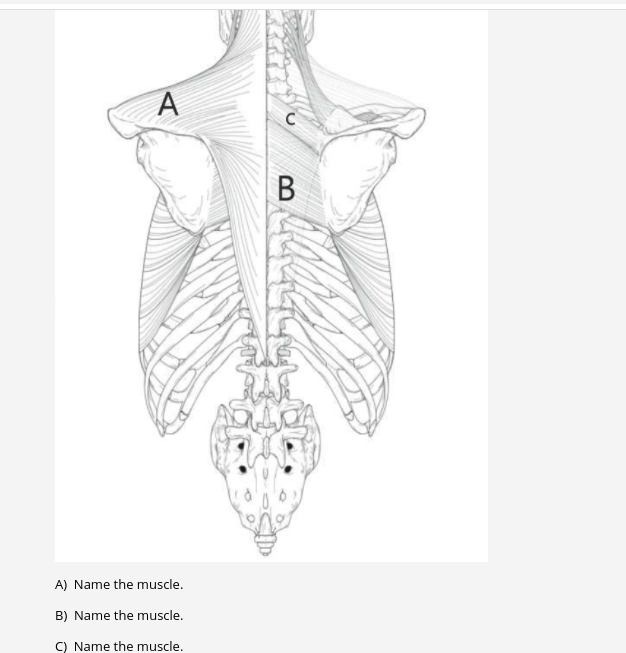 Solved A B A) Name the muscle. B) Name the muscle. C) Name | Chegg.com