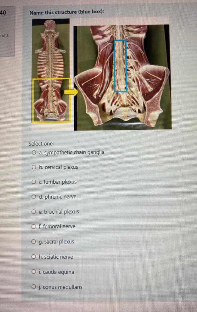 Sympathetic Chain Ganglia Model