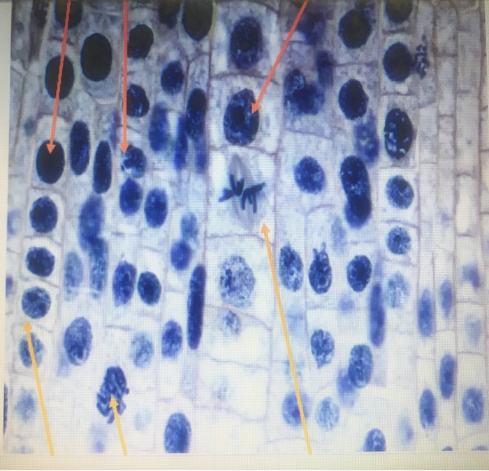 Solved Label the slide images below with the appropriate | Chegg.com