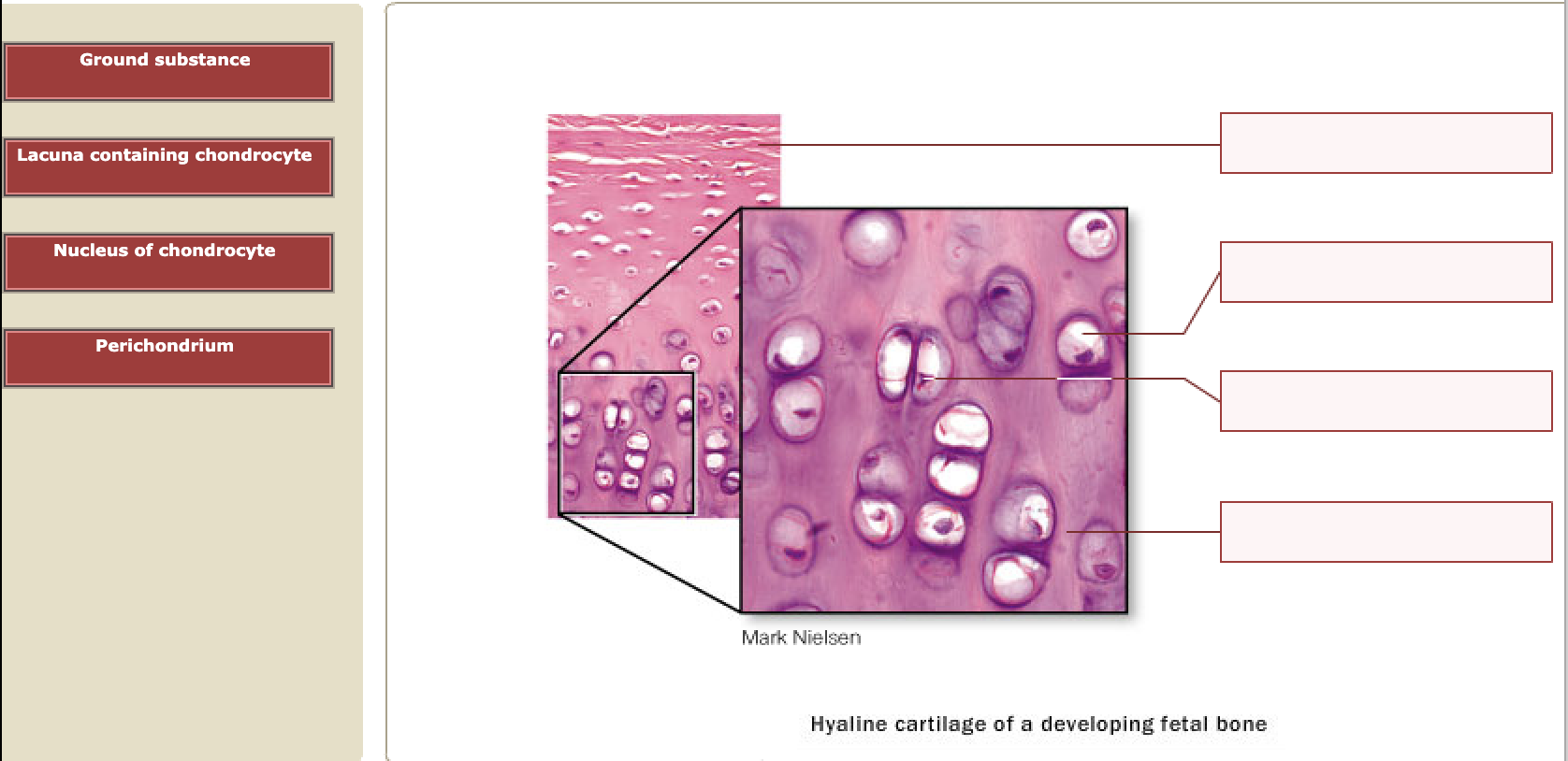 Solved Ground substance Lacuna containing chondrocyte | Chegg.com