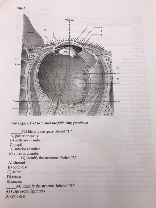 Solved Page 7 ieual axis Nose Lens 10 12 13 Orbital at Use | Chegg.com