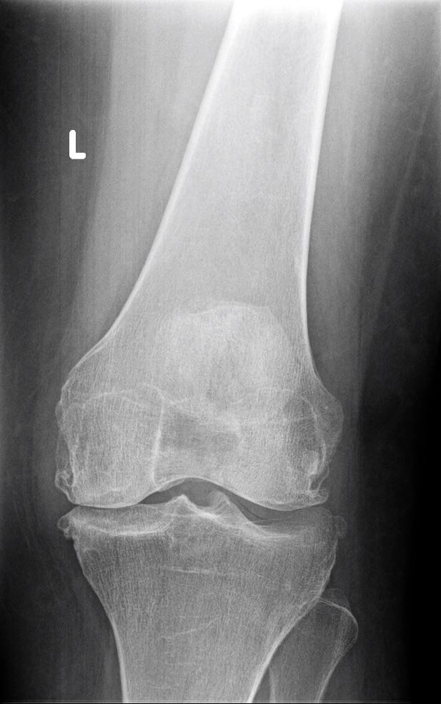 9.34 AM Thu Apr 6 Radiology Report PATIENT INITIALS: | Chegg.com