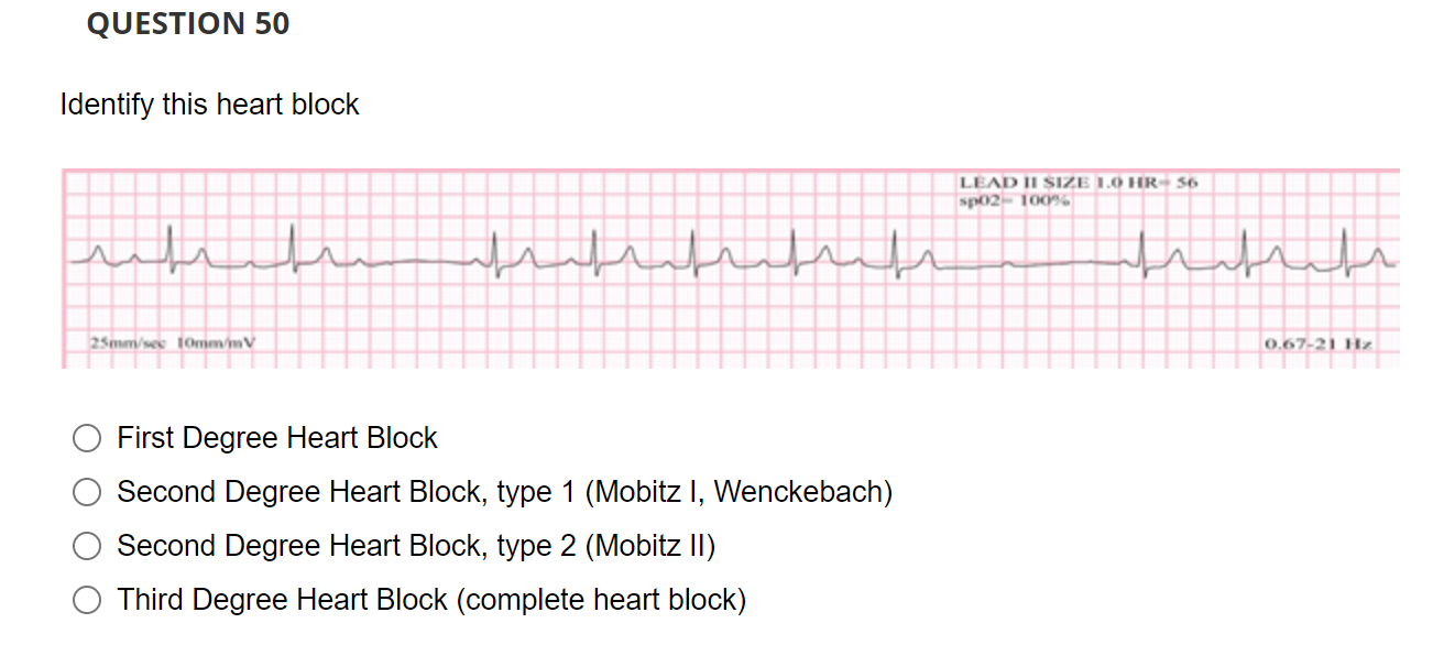 Solved QUESTION 50 Identify this heart block سلسلي سلسلي | Chegg.com