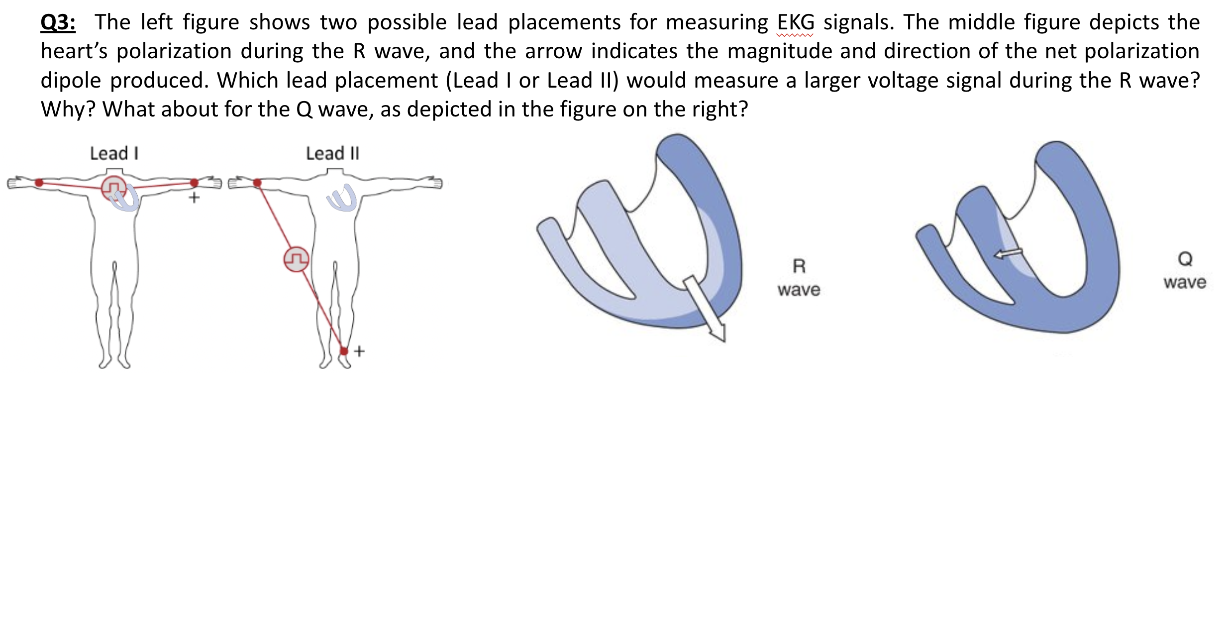 Solved Q3: The left figure shows two possible lead | Chegg.com