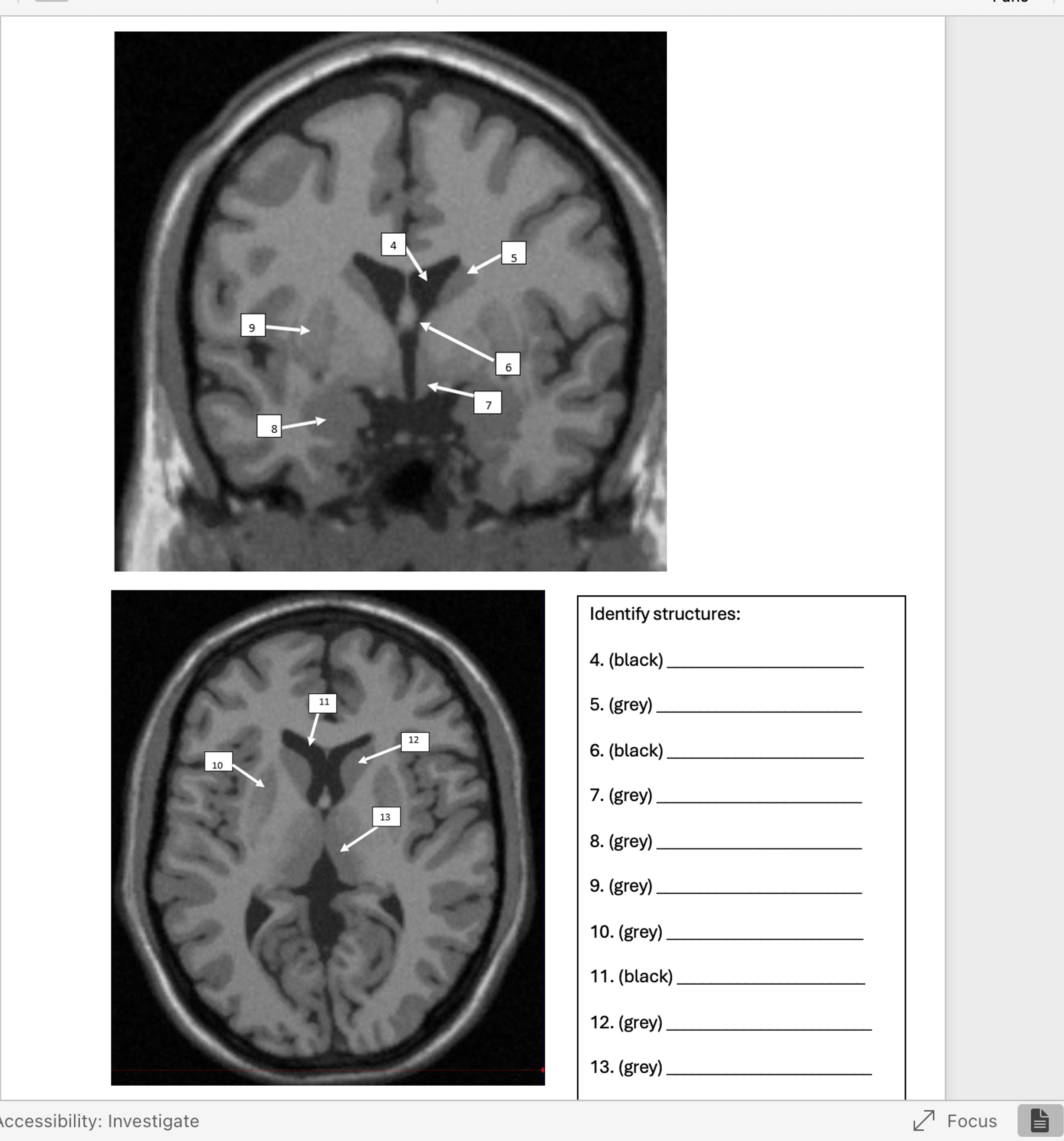 Solved Identify structures on brain MRI Identify | Chegg.com