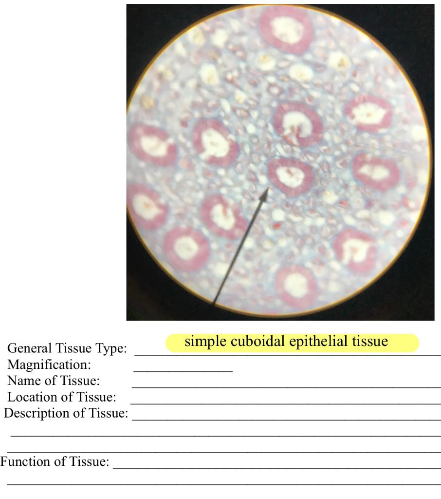 Solved simple cuboidal epithelial tissue General Tissue | Chegg.com