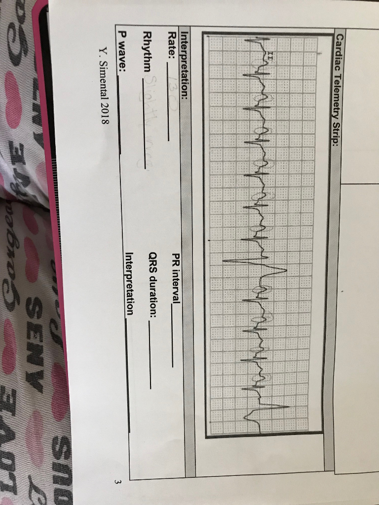 Solved Cardiac Telemetry Strip: Interpretation: Rate: Rhythm | Chegg.com