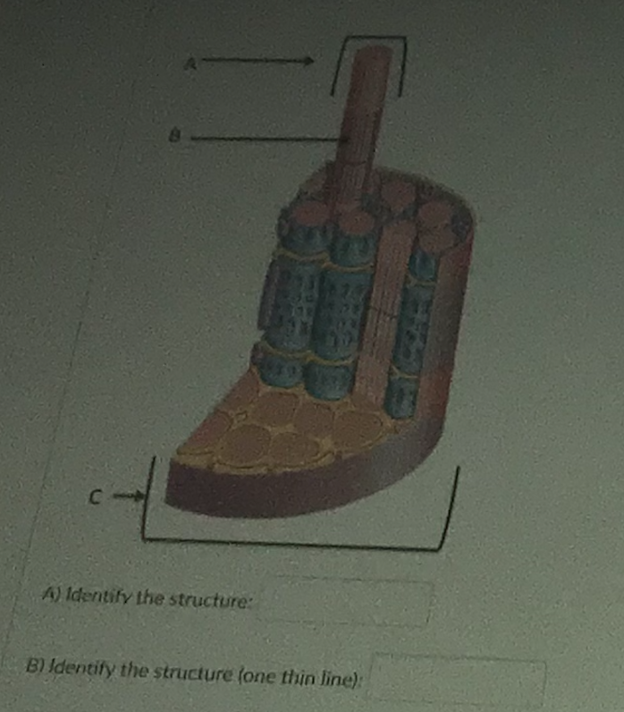 Solved A) Identify the structure B) Identify the structure | Chegg.com