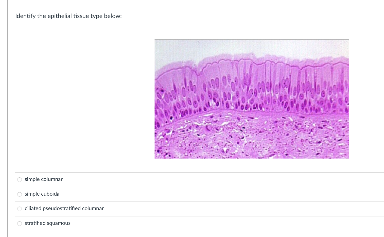 Solved Identify the epithelial tissue type below: simple | Chegg.com