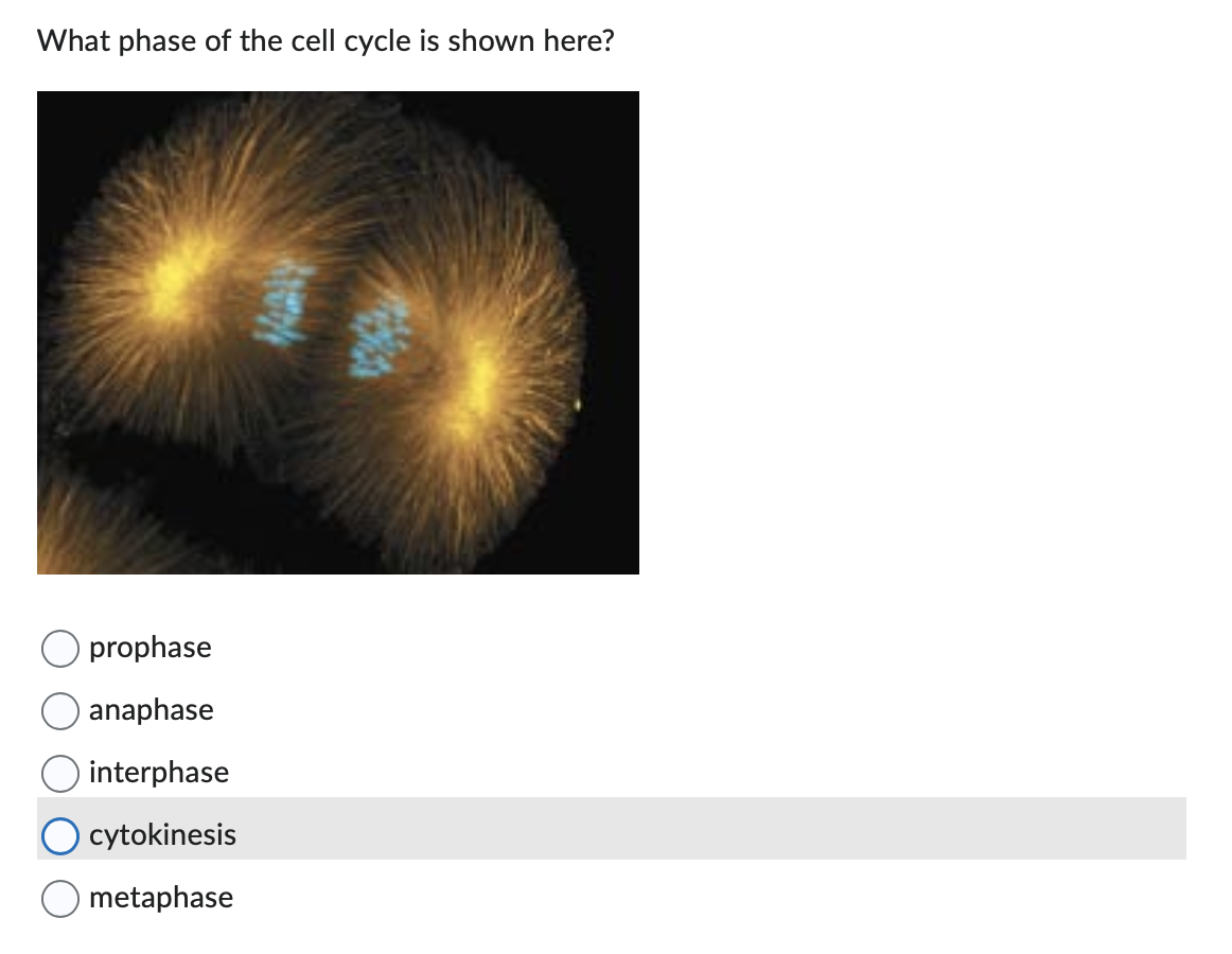 What phase of the cell cycle is shown here? prophase | Chegg.com