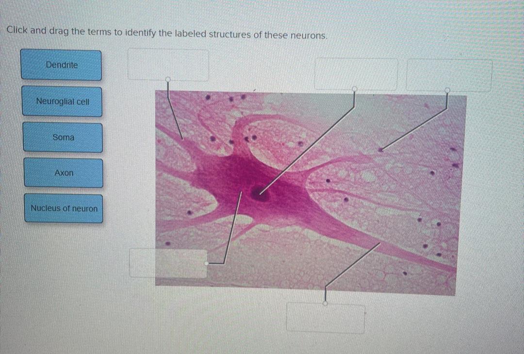 Solved Click and drag the terms to identify the labeled | Chegg.com