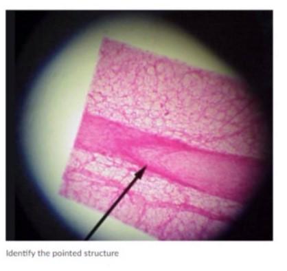 Solved Identify the pointed structure | Chegg.com