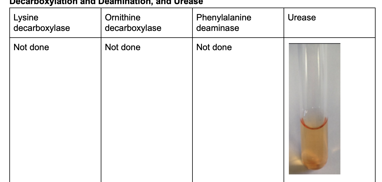 Decarboxylation and Deamination, and Urease Urease | Chegg.com