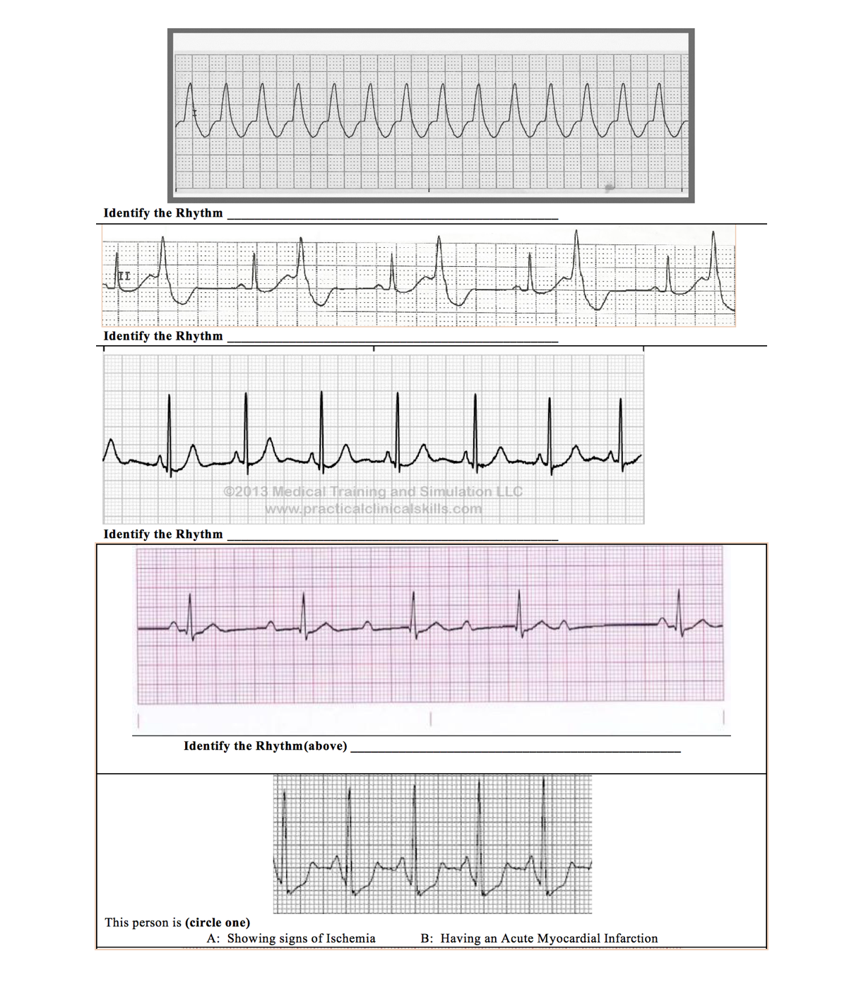 Solved اااااااااااا Identify the Rhythm Identify the Rhythm | Chegg.com