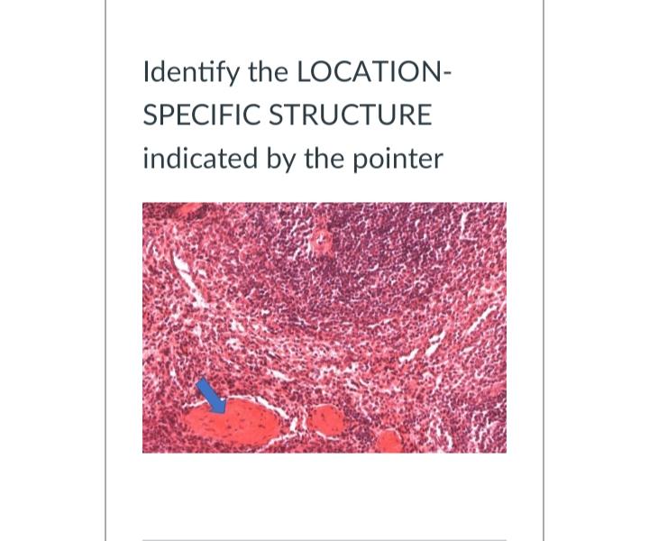 Solved Identify the LOCATION- SPECIFIC STRUCTURE at the tip | Chegg.com
