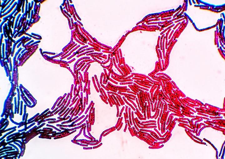 Solved 1.) In most differential and structural stains, | Chegg.com