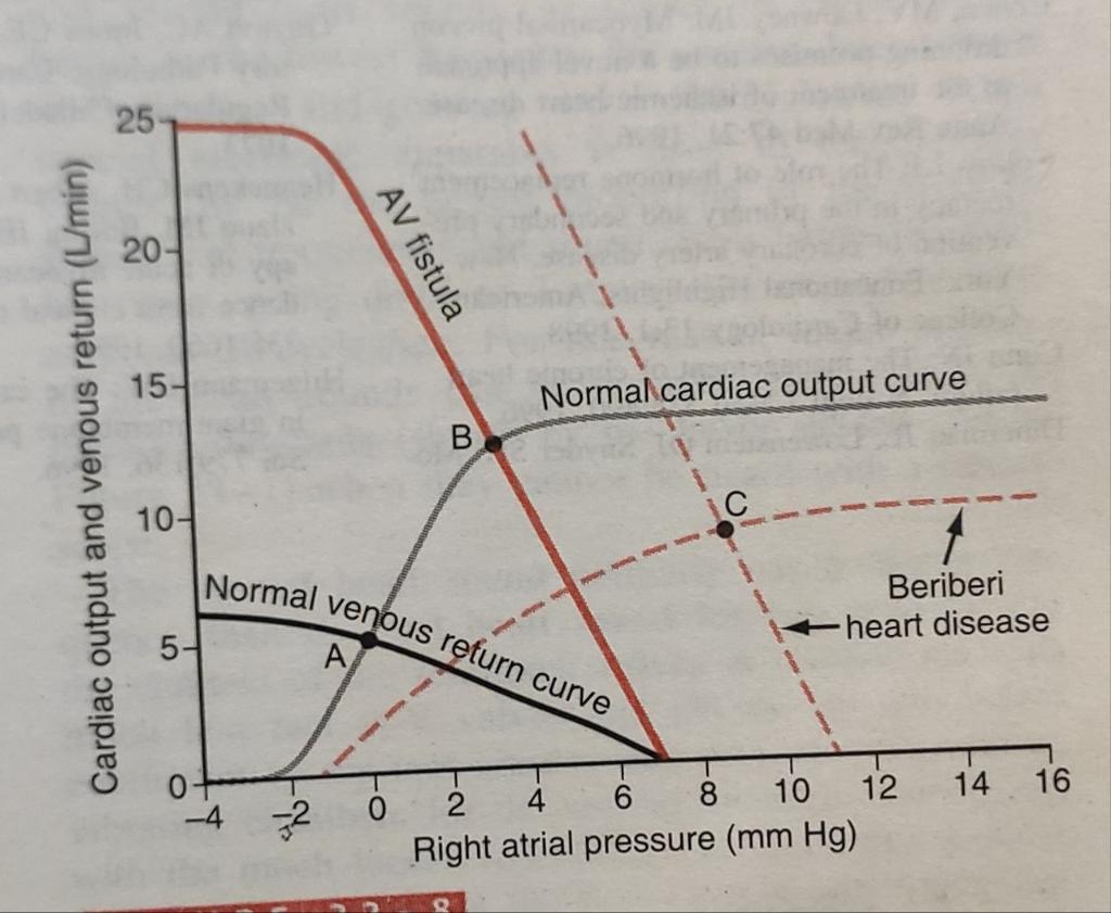 Solved 25 20- AV fistula 15- Normal cardiac output curve B | Chegg.com