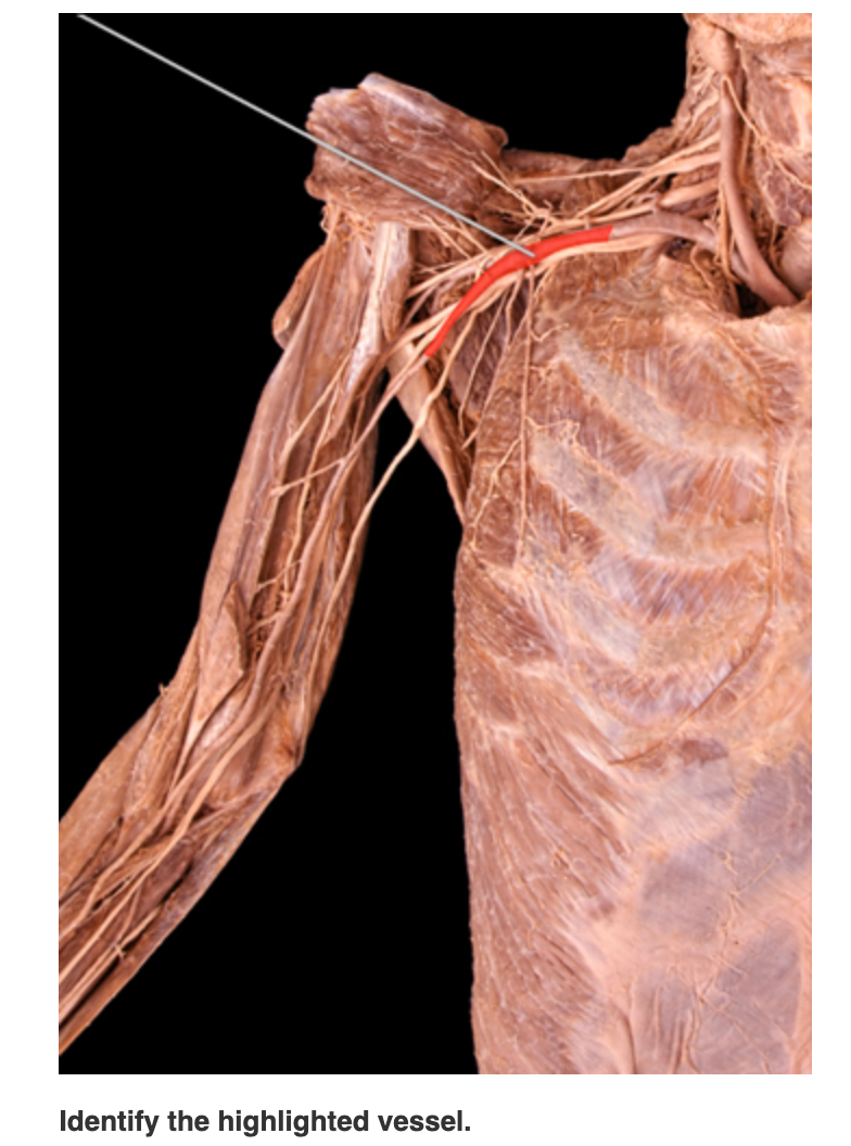 Solved LT G12: Giant Identify the highlighted vessel. left | Chegg.com