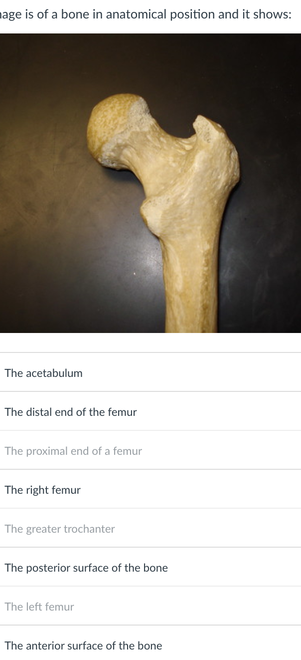 Solved age is of a bone in anatomical position and it shows: | Chegg.com