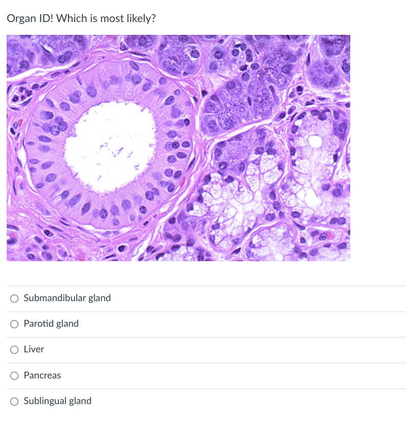 Solved Organ ID! Which is most likely? Submandibular gland | Chegg.com
