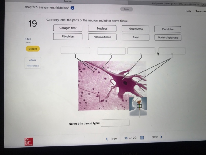Solved Connect chapter 5 assignment (histology) Help | Chegg.com Solved Connect chapter 5 assignment (histology) Help | Chegg.com