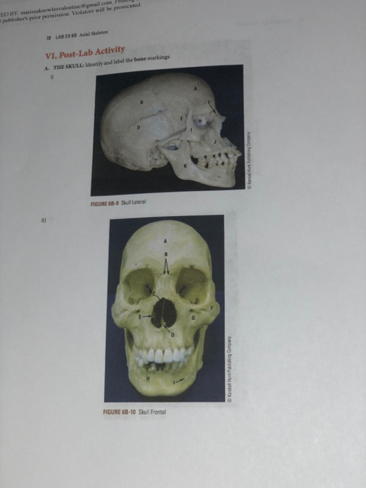 Solved R. Complete this table describing bone classification | Chegg.com Solved R. Complete this table describing bone classification | Chegg.com