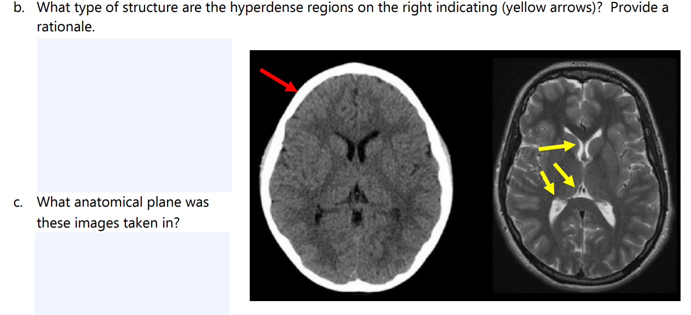 Solved b. What type of structure are the hyperdense regions | Chegg.com