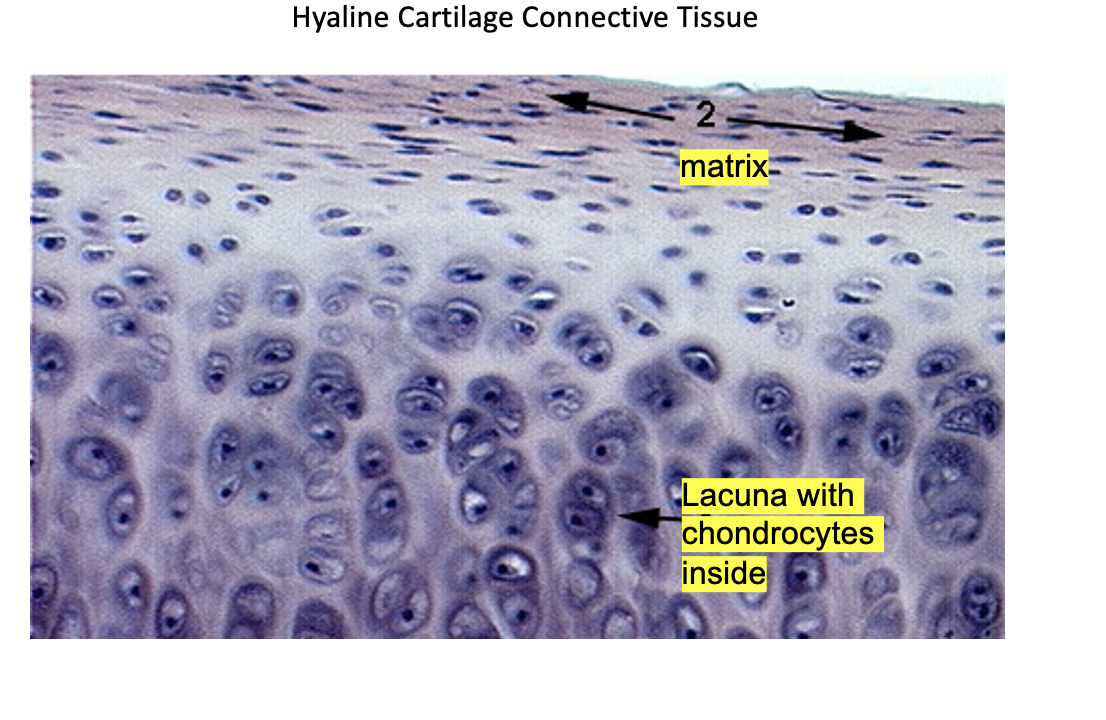 Solved Hyaline Cartilage Connective Tissue matrix Lacuna | Chegg.com