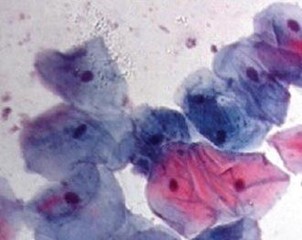 Solved B. ﻿Smear from an epithelial cell:PROTOCOL - ﻿BUCCAL | Chegg.com