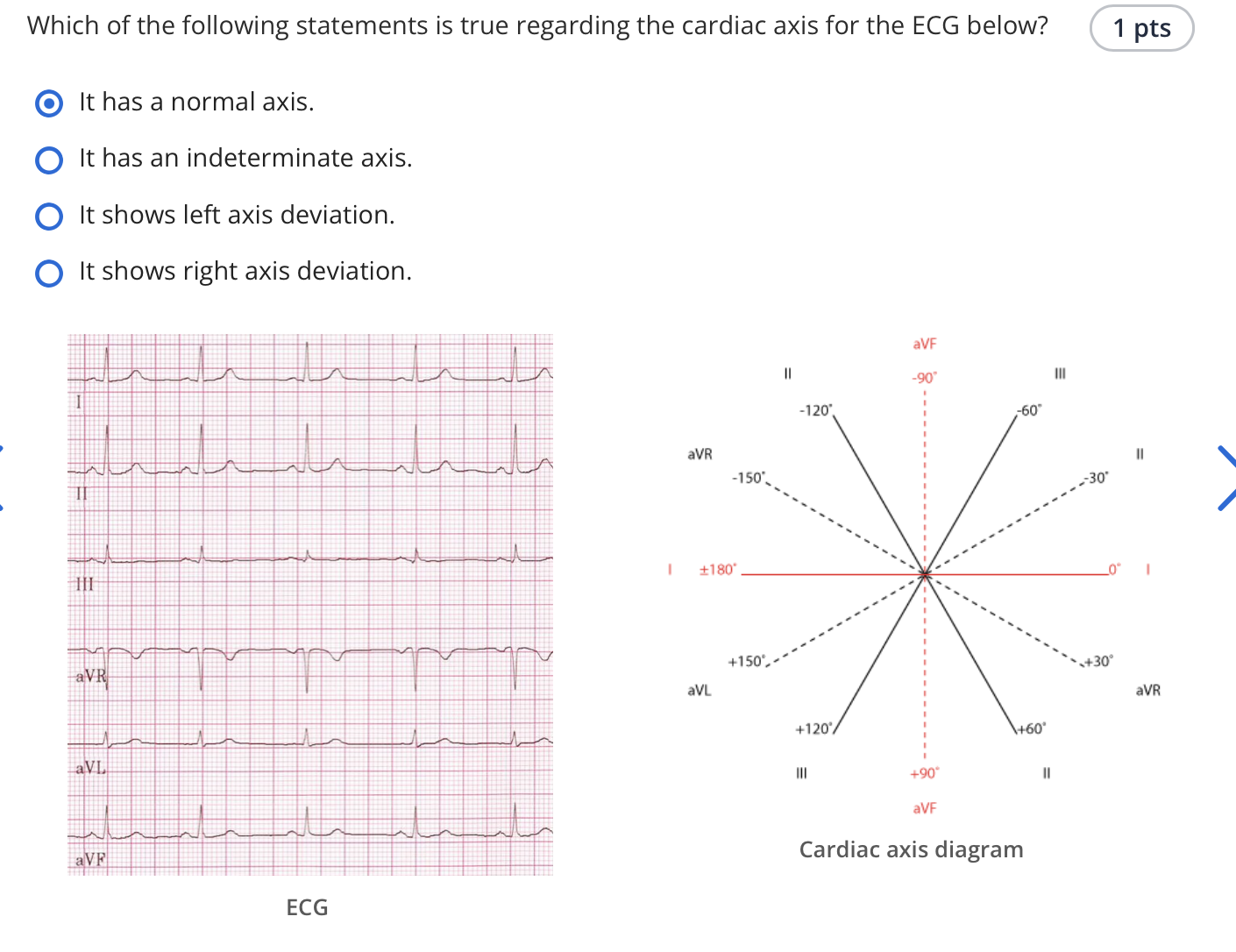 Solved Which of the following statements is true regarding | Chegg.com