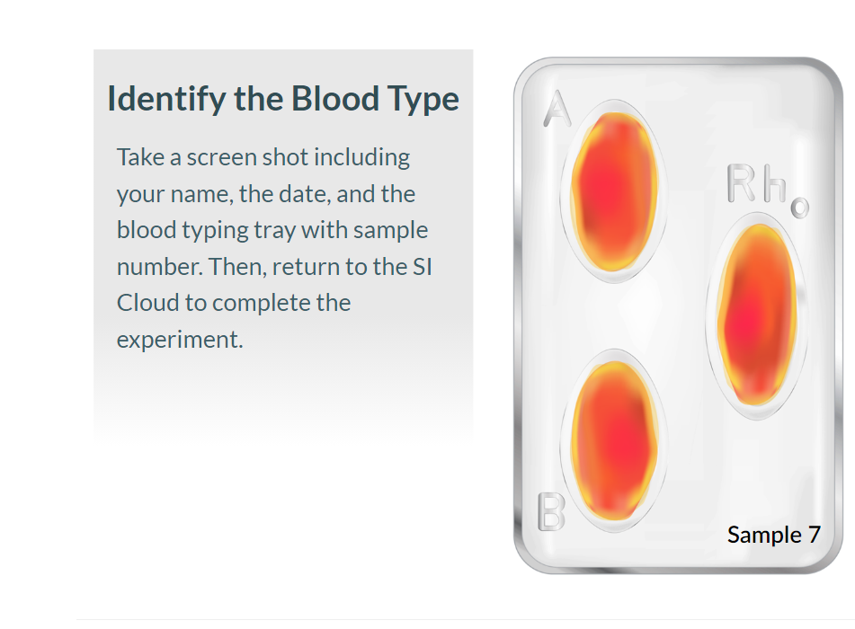 Determine the blood type and explain your findings in | Chegg.com