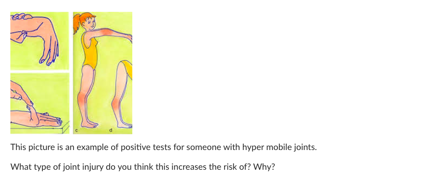 This picture is an example of positive tests for | Chegg.com
