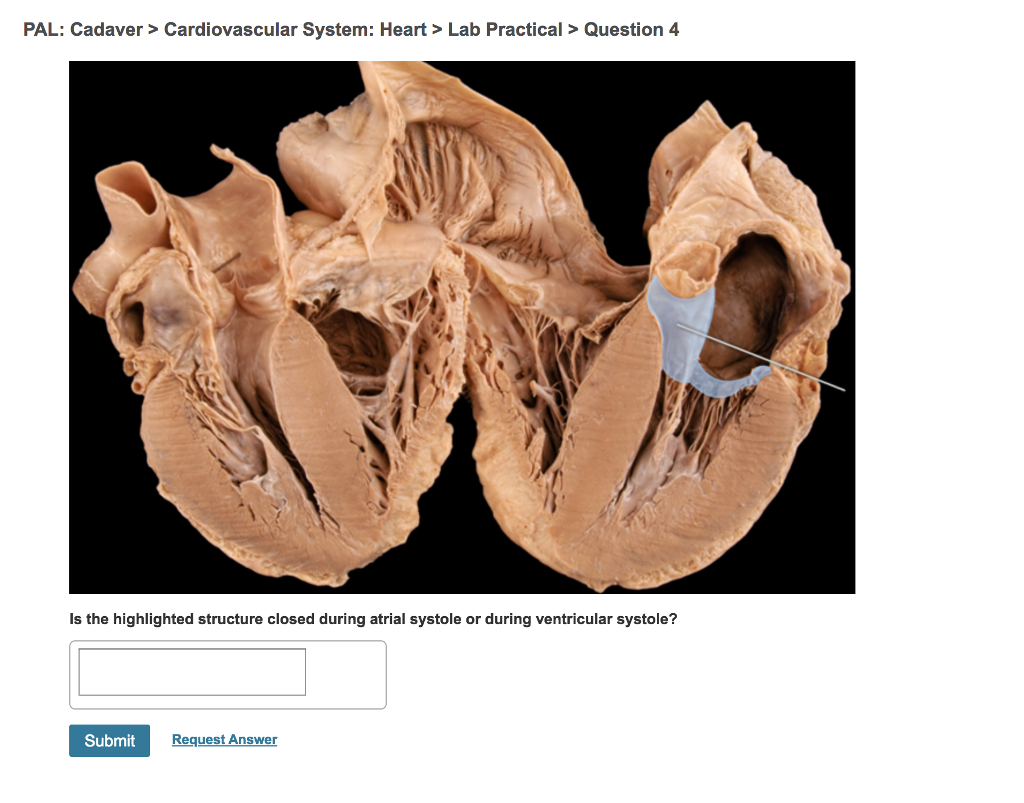 Solved PAL Cadaver Cardiovascular System Heart Lab Chegg