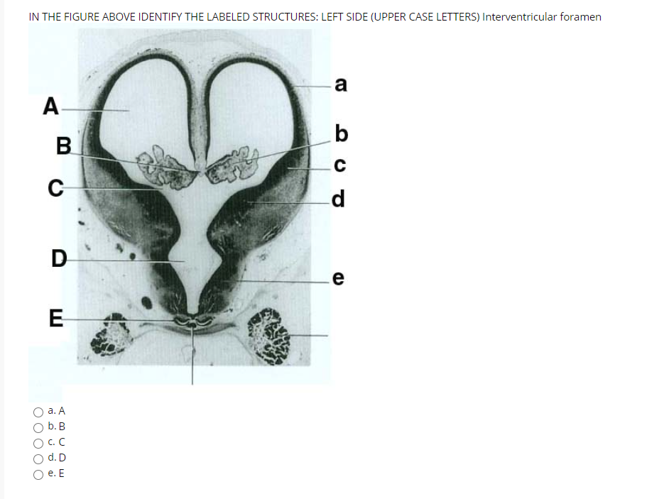 Solved IN THE FIGURE ABOVE IDENTIFY THE LABELED STRUCTURES: | Chegg.com
