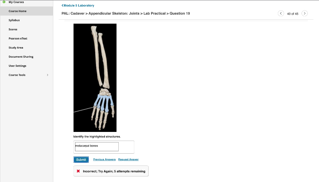 PAL: Cadaver > Appendicular Skeleton: Joints > Lab | Chegg.com PAL: Cadaver > Appendicular Skeleton: Joints > Lab | Chegg.com
