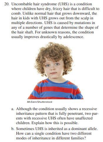 Solved 20. Uncombable hair syndrome (UHS) is a condition | Chegg.com