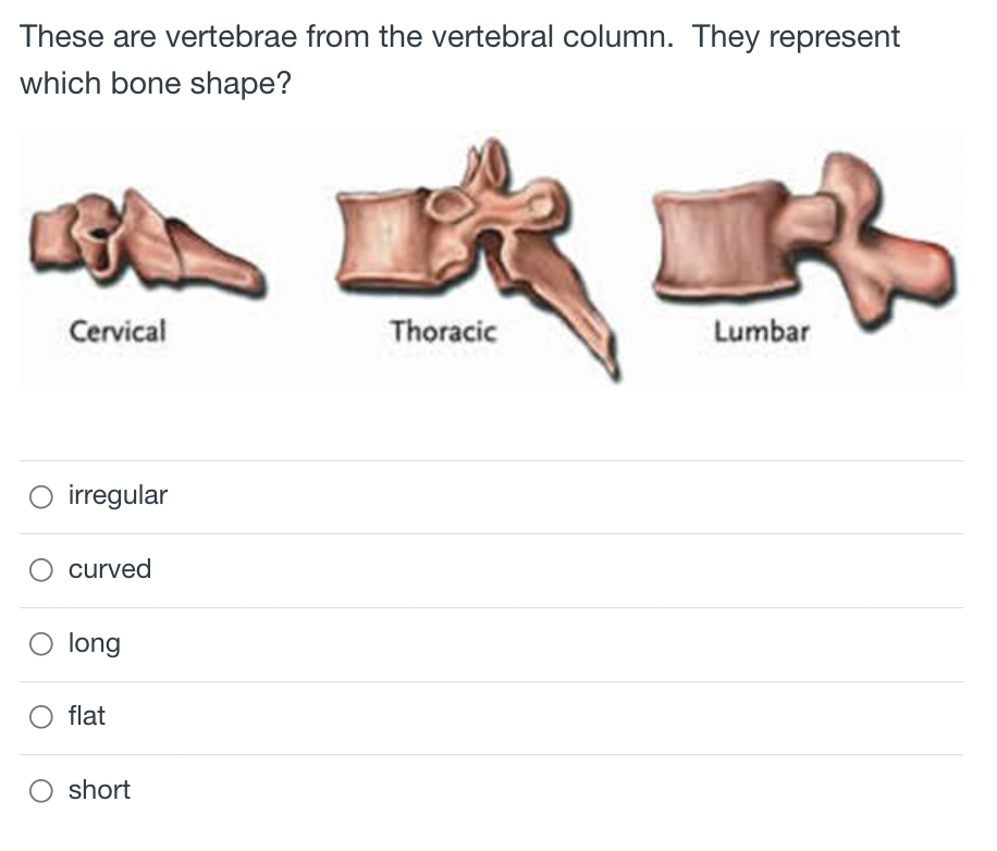 These are vertebrae from the vertebral column. They | Chegg.com