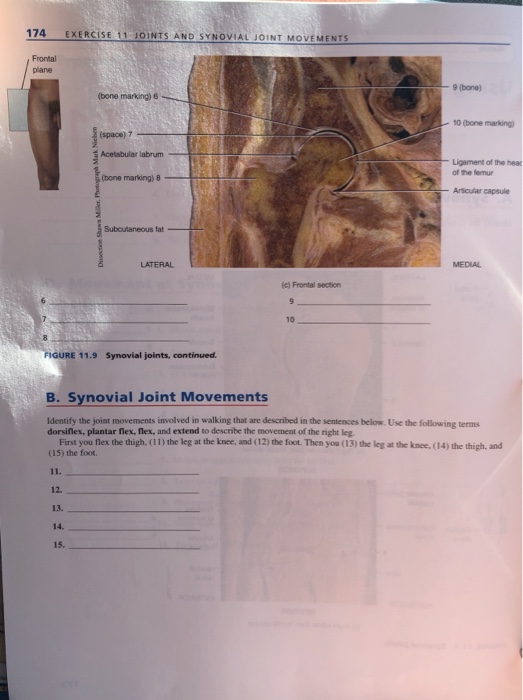 Solved Using Your Knowledge A. Synovial Joints Identify the | Chegg.com