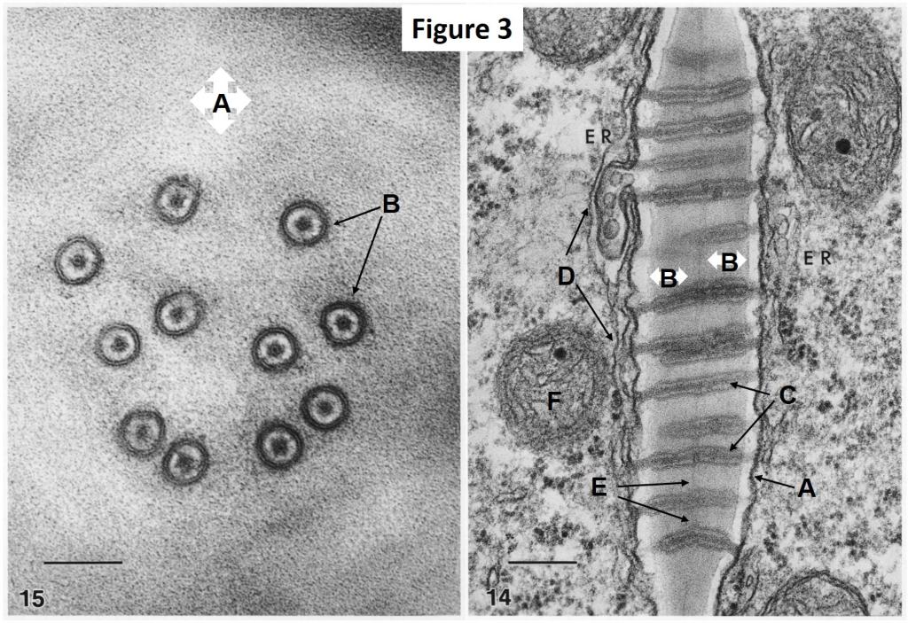 Solved Figure 3 shows electron micrographs of plasmodesmata. | Chegg.com