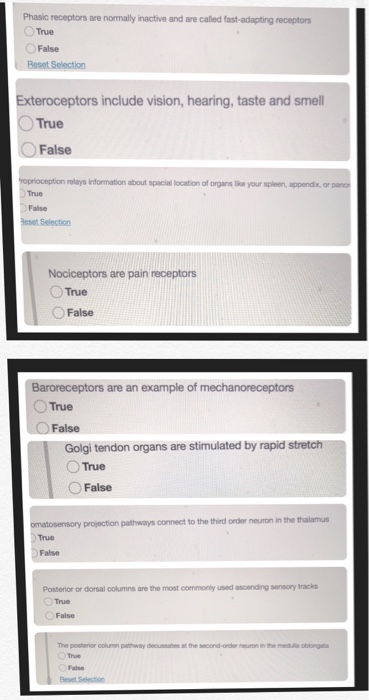 Solved Phasic receptors are normally inactive and are called | Chegg.com