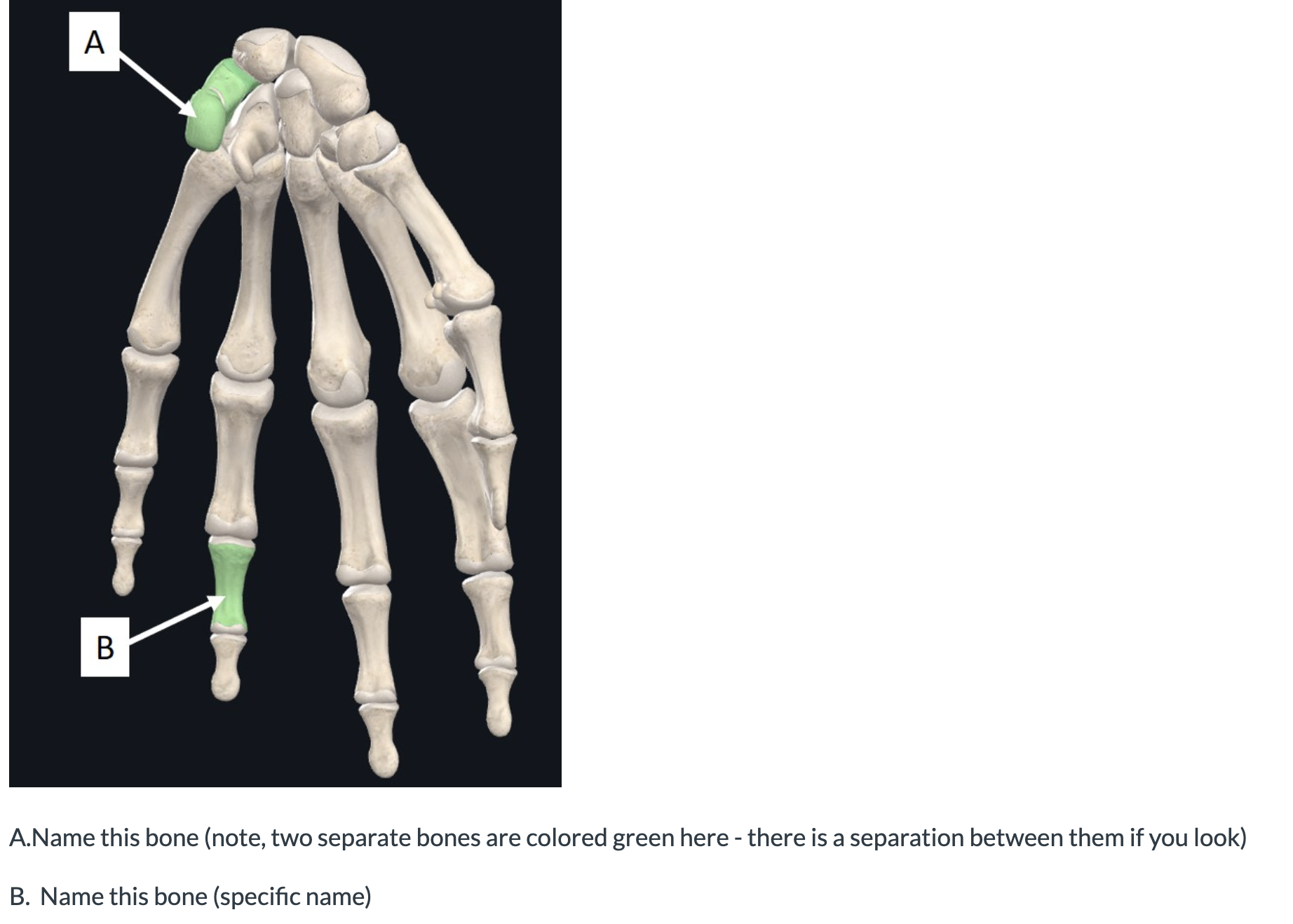 Solved A.Name this bone (note, two separate bones are | Chegg.com